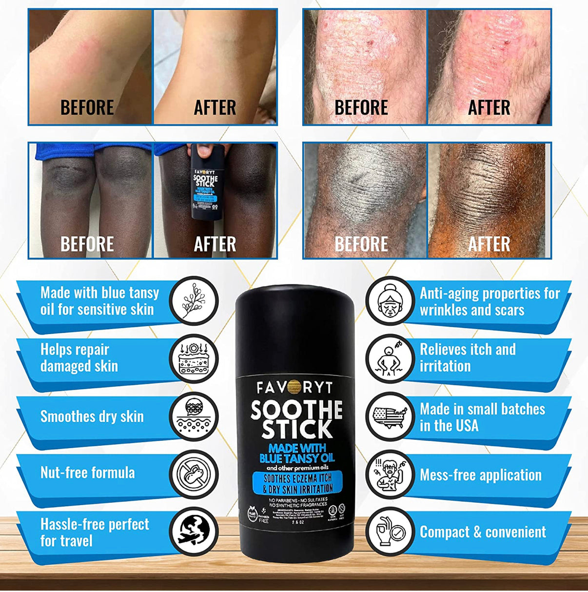 Soothe Stick Skin Balm Stick for Eczema and Dry, Cracked Skin, Soothin ...